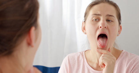 Các triệu chứng viêm amidan đáy lưỡi và cách đối phó hiệu quả
